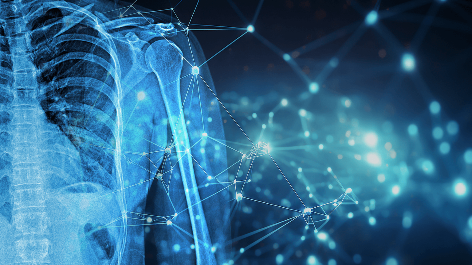 AI on CPUs - A PoC for Healthcare - Futurum